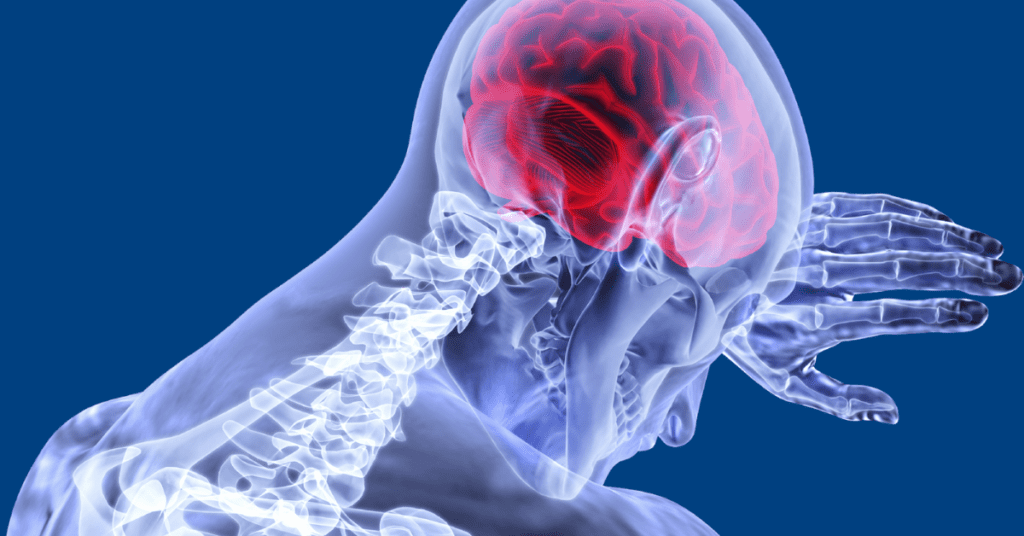 Creating Life Saving Stroke Detection Platform With Ai